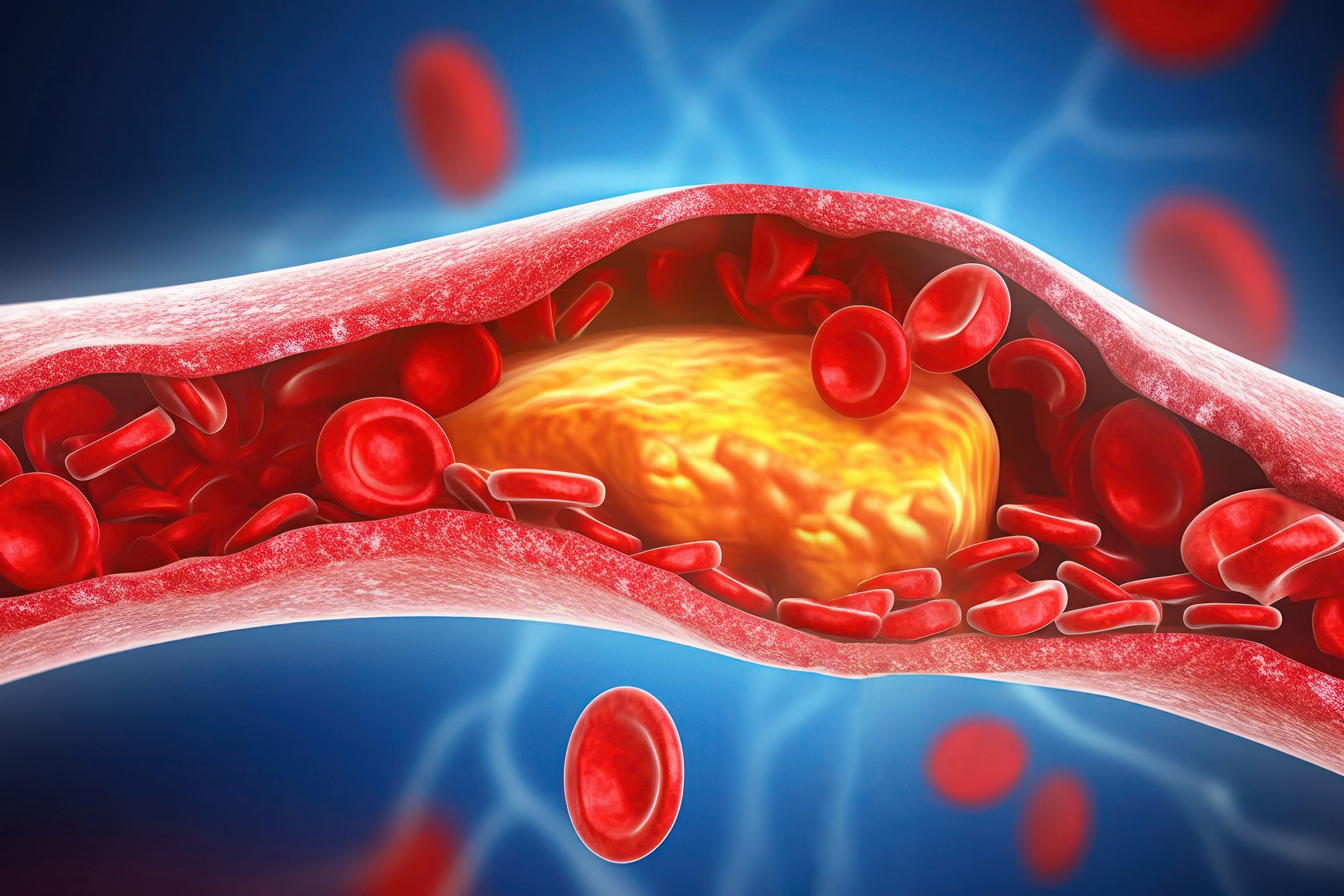 Heart Health & Cholesterol – What women (and men) NEED to Know.